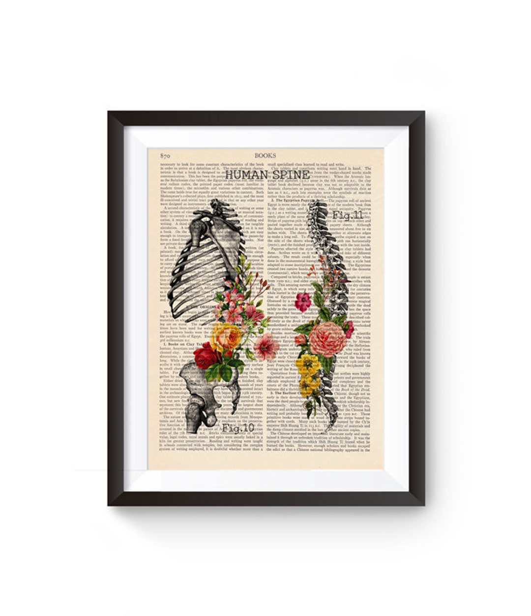 Spine Print, Anatomy Book Art, Orthopedic Doctor Gift,chiropractic Gift ...
