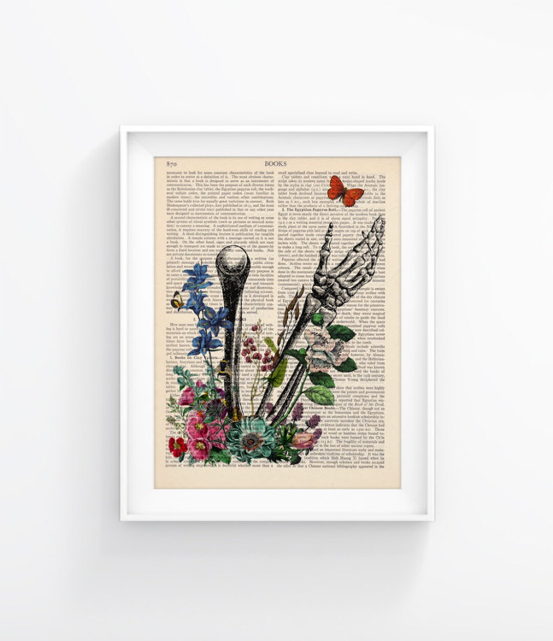 Anatomy Print, Medical Poster Vintage Illustration / Skeleton Arm Wall ...