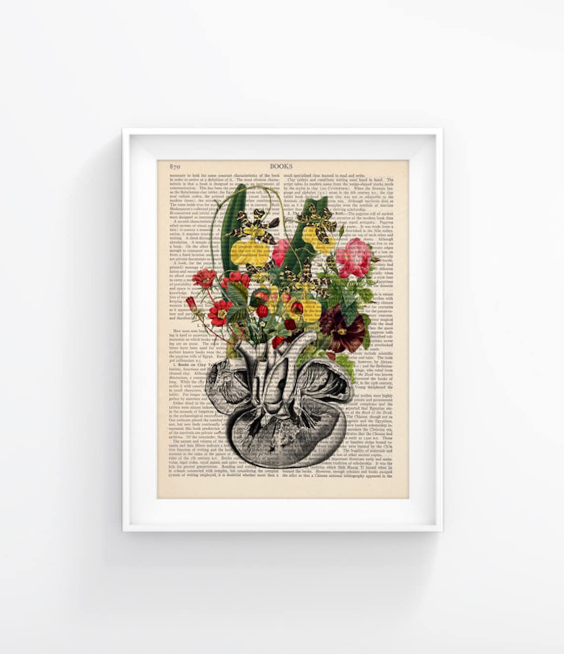 Kidney Anatomy Print Medical Poster Anatomy Vintage | Etsy