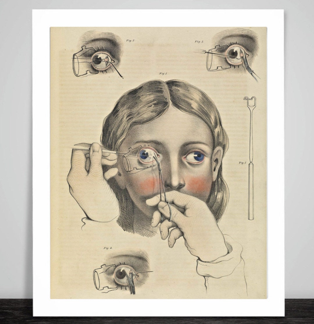 Print Poster Eye Test. Vintage Anatomy Surgery Medical Chart . Optician ...
