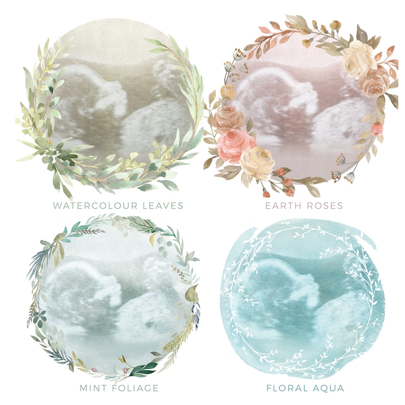 FRAMED Watercolour Baby Scan Print Art Baby Scan Frame Baby - Etsy