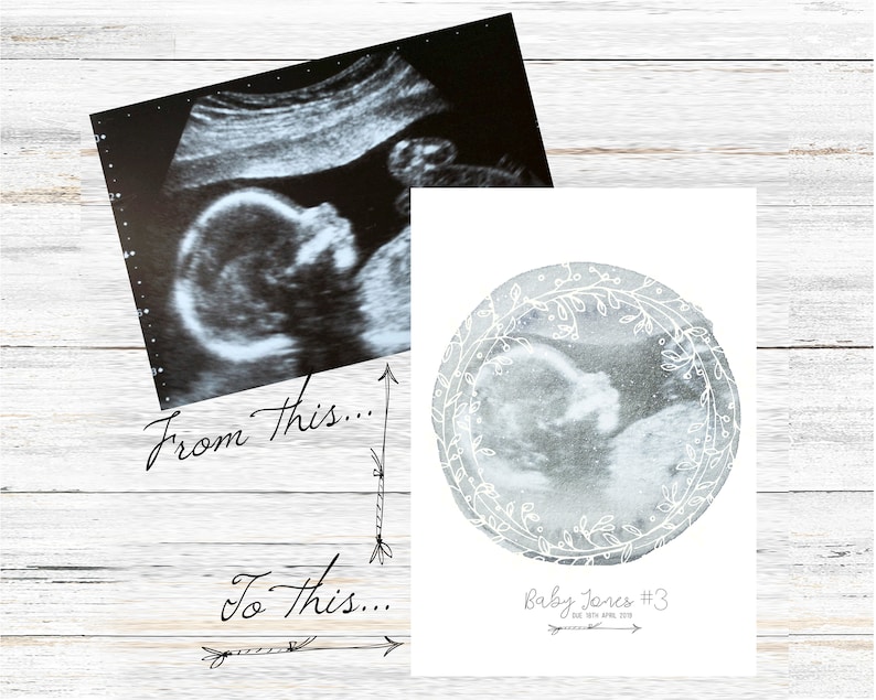 FRAMED Watercolour Baby Scan Print Art Baby Scan Frame Baby - Etsy UK