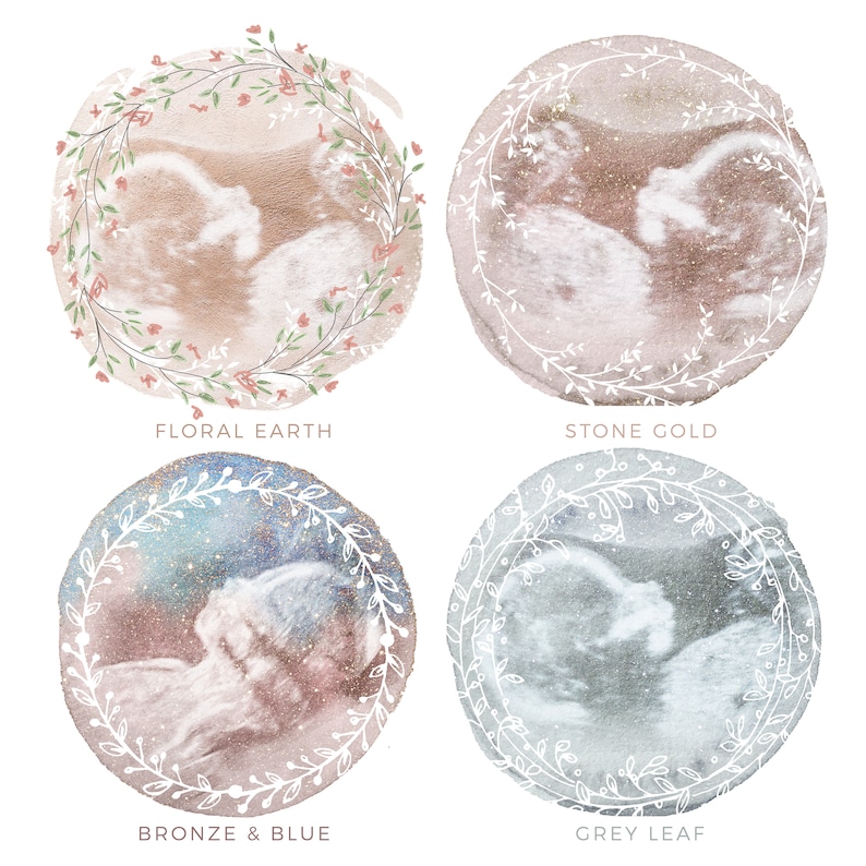 FRAMED Watercolour Baby Scan Print Art Baby Scan Frame Baby - Etsy UK