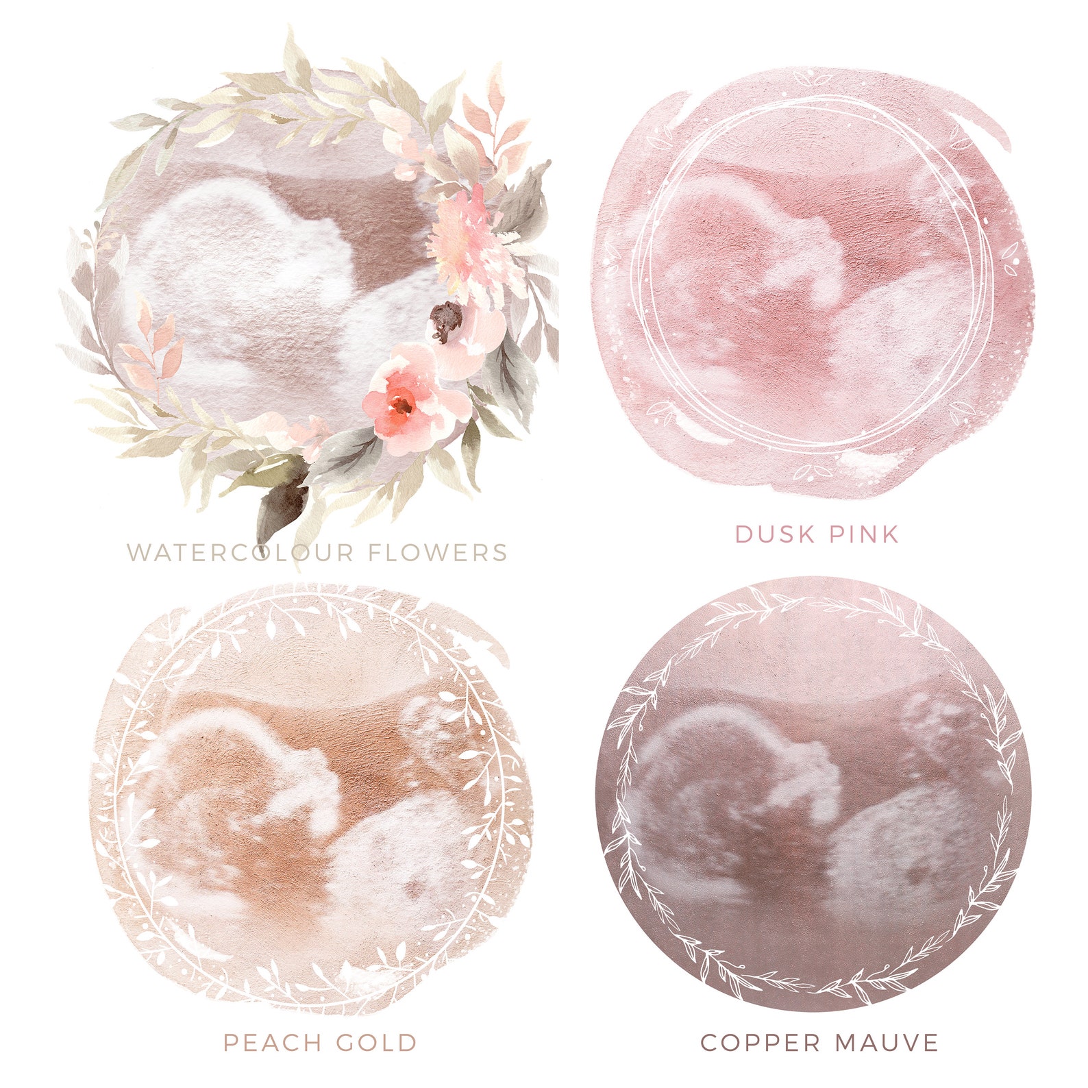 FRAMED Watercolour Baby Scan Print Art Baby Scan Frame Baby - Etsy