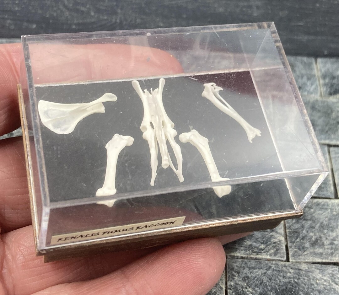 Assorted Bones - Pelvis, Leg Bones, Shoulder Blade and Arm Bone in ...