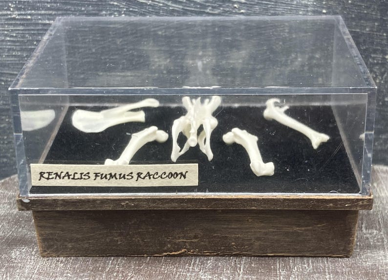 Assorted Bones - Pelvis, Leg Bones, Shoulder Blade and Arm Bone in ...