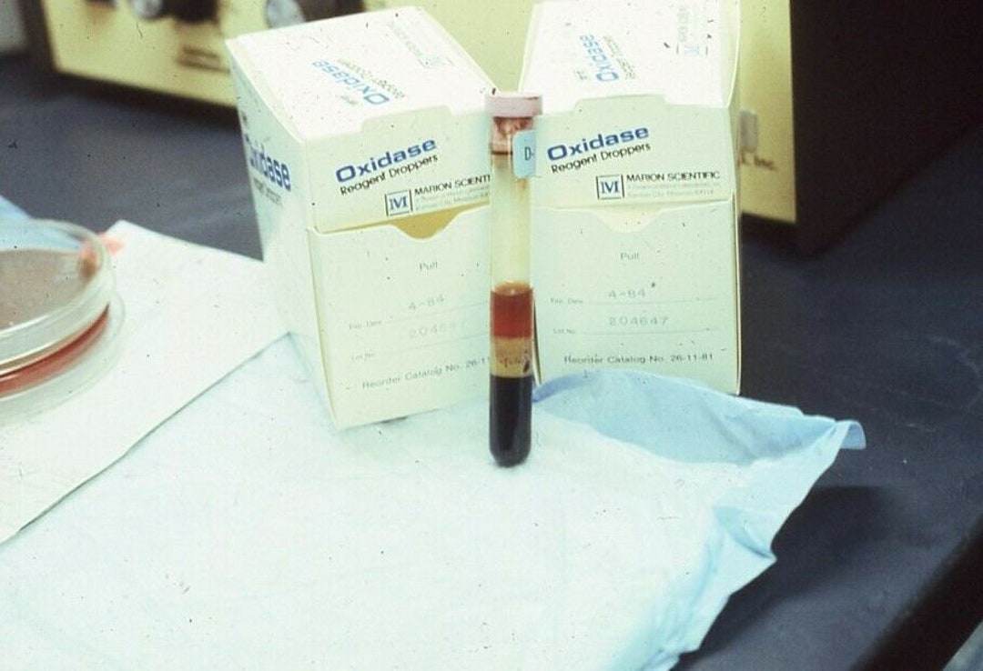 Vintage Photo 35mm Slide Oxidase Marion Scientific Reagent Dropper ...