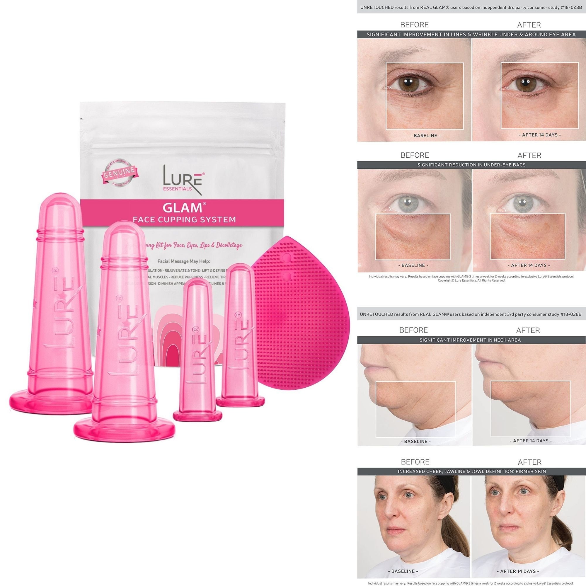 GLAM Face Cupping Set FREE Shipping - Etsy