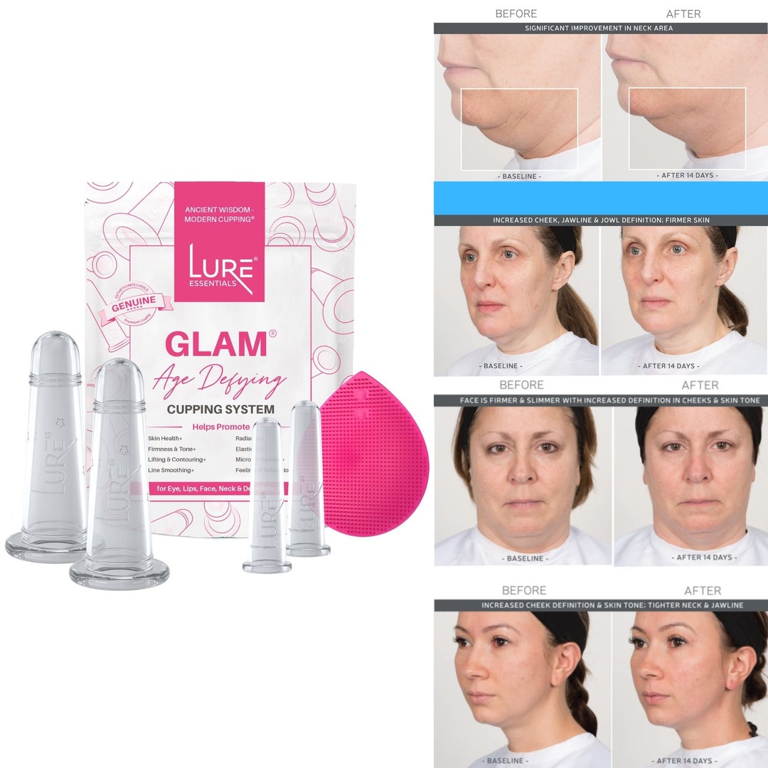 GLAM Face Cupping Set FREE Shipping - Etsy