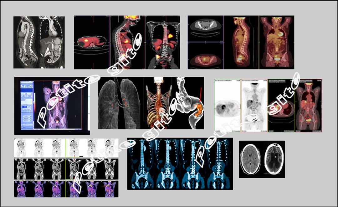 9 Miniature Physician Doctor Medical X-RAY, MRI & CT Scans - Dollhouse ...