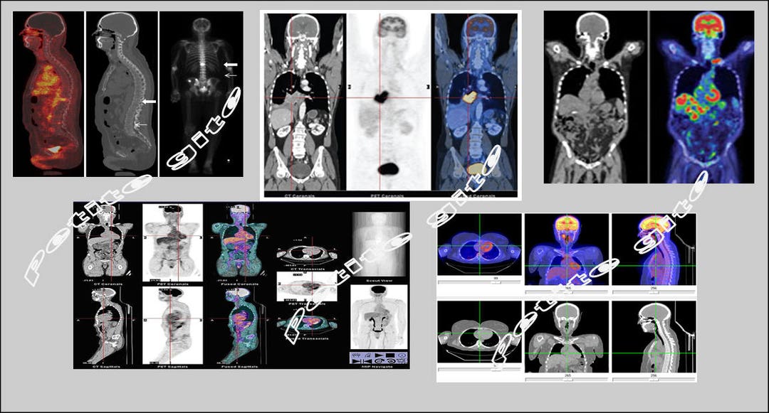 5 Miniature Physician Doctor Medical X-RAY, MRI & CT Scans - Dollhouse ...