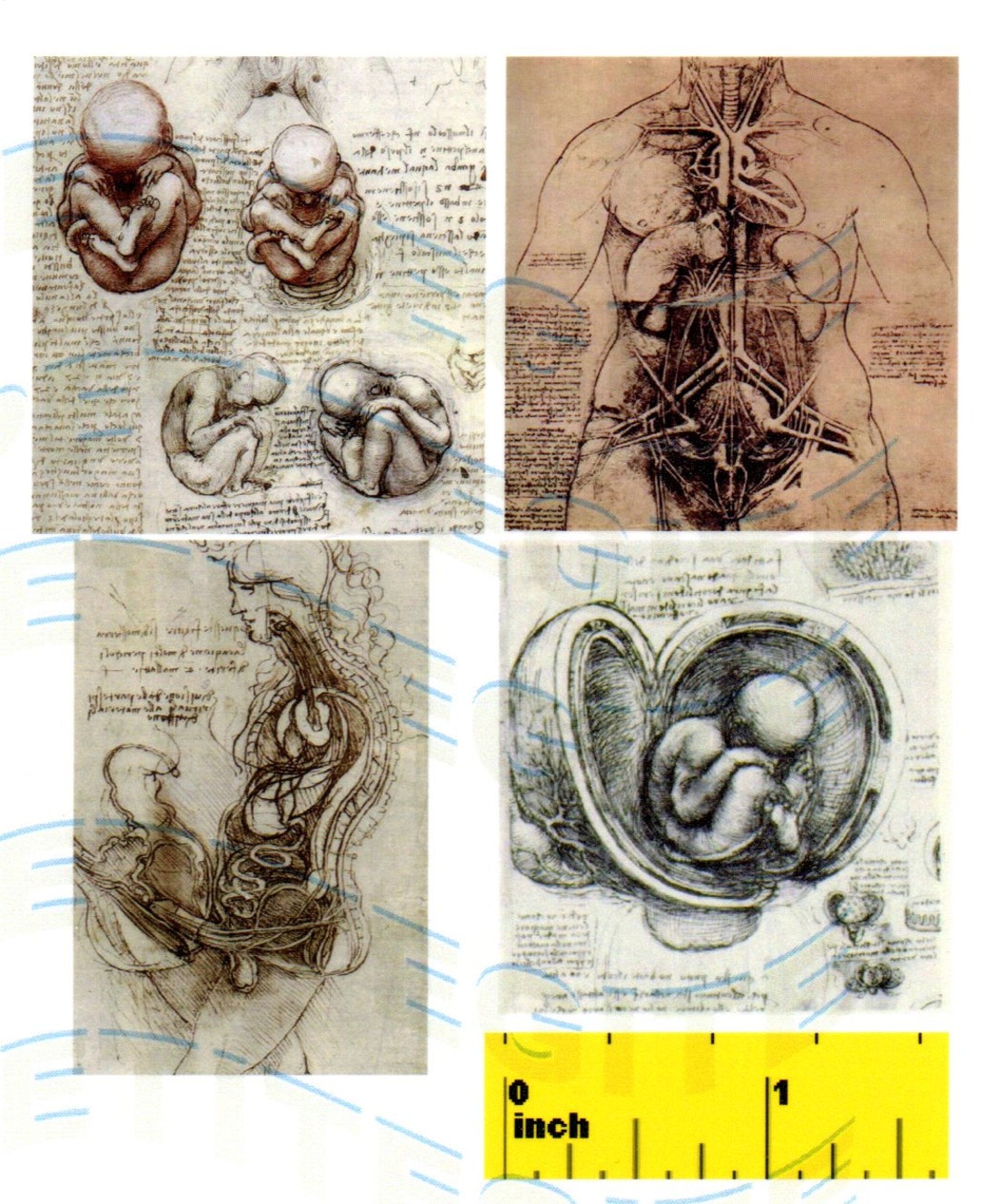 Miniature OB/GYN Doctor Physician Medical Medieval Picture Prints ...