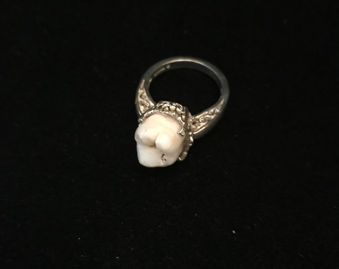 Your Own Custom Tooth Ring - Etsy