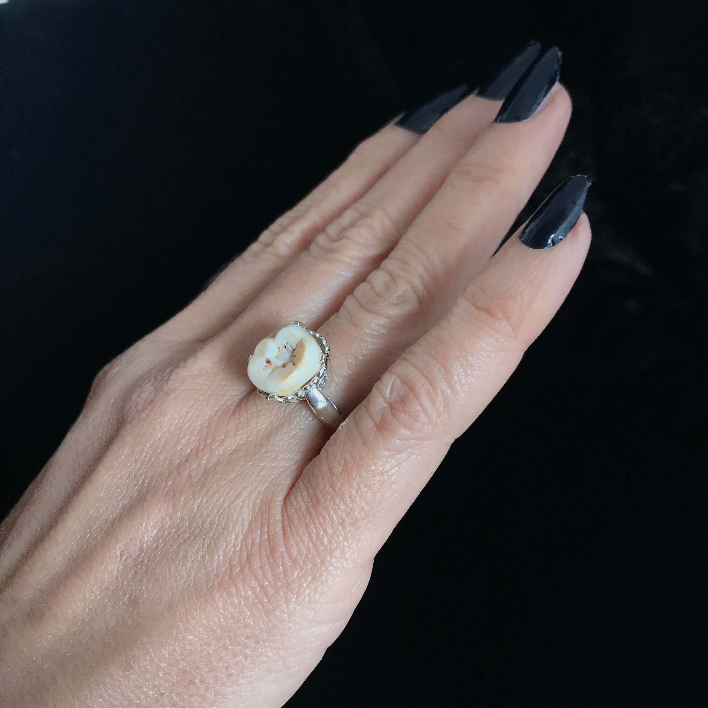 Real Human Tooth Ring//human Molar in Sterling Silver 12mm - Etsy UK
