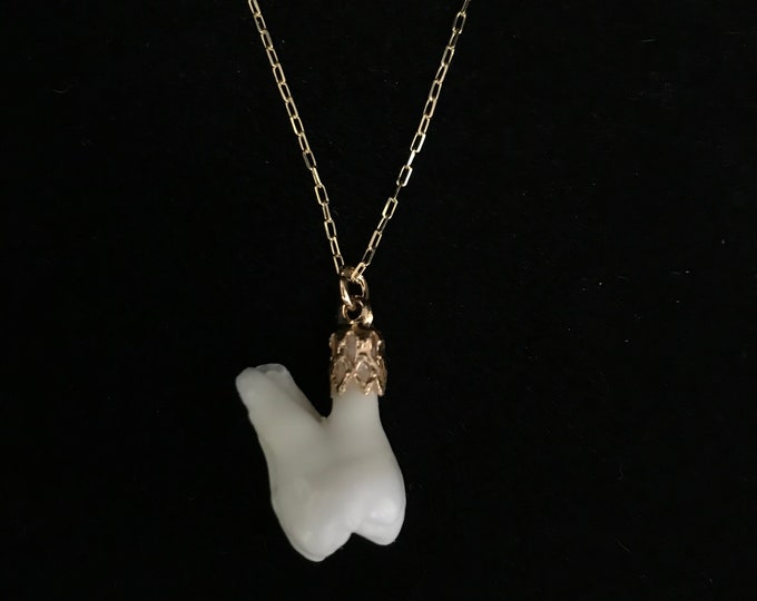 How to Guide for Tooth Gems - Etsy