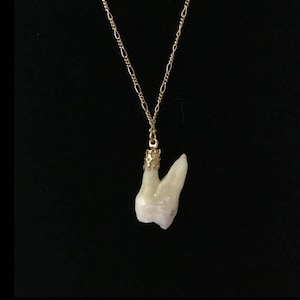 Real Human Molar Tooth Necklace//12k Gold Filled 20 Figaro Chain//tooth ...