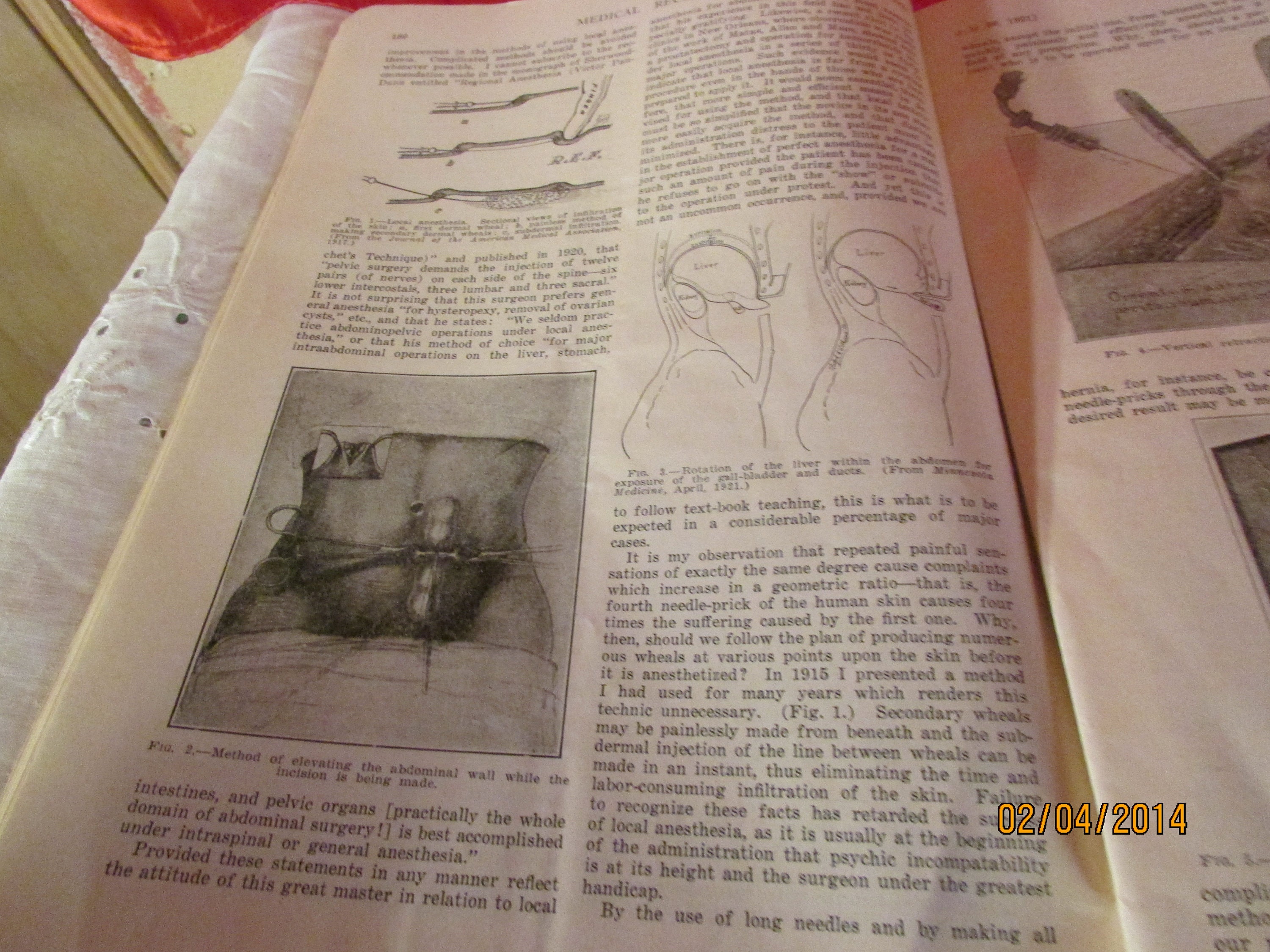 1921 Medical Record A Weekly Journal of Medicine & Surgery William Wood ...