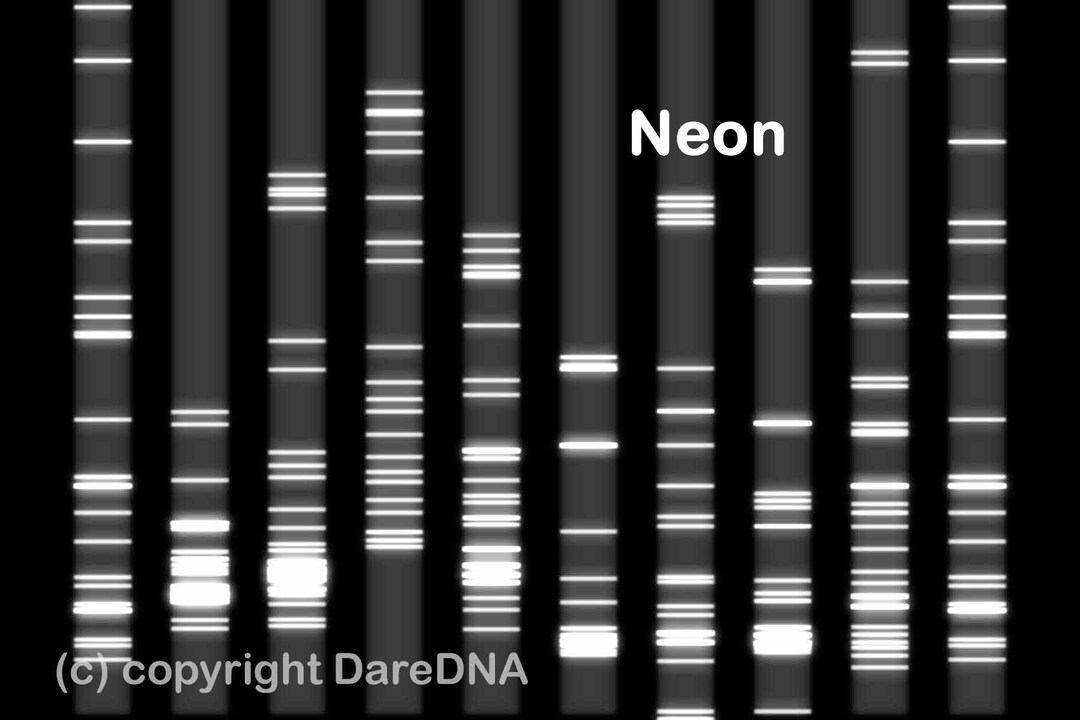 Unique DNA Portraits: Your Genetic Story on Canvas Black - Etsy