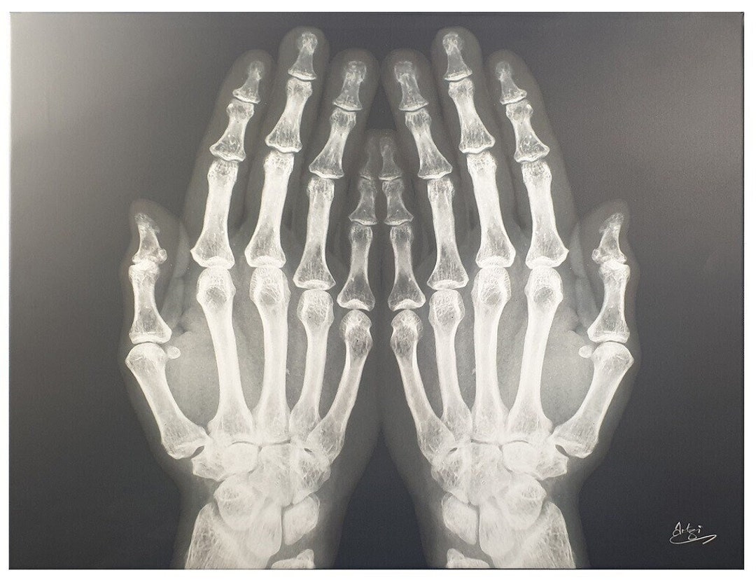 Dua Hands X-ray Art Original Giclée Canvas Islamic Wall Art Gift Giclee ...