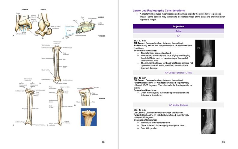 Rad Notes - Lower Extremity - Radiography Study Guide *digital Copy* - Etsy