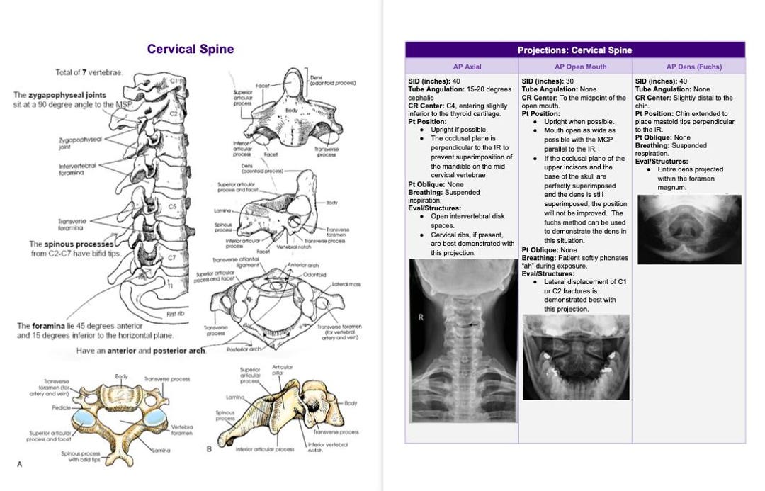 Rad Notes - Spine - Radiography Study Guide *digital Copy* - Etsy