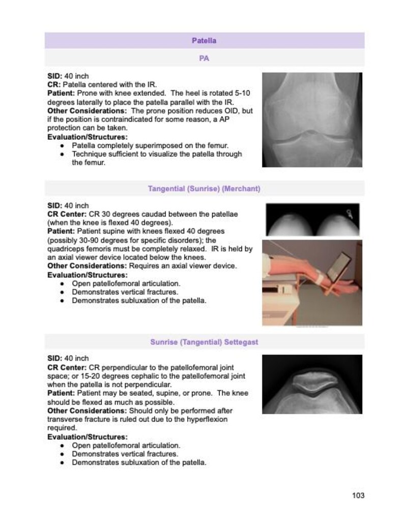 Rad Notes - Lower Extremity - Radiography Study Guide *digital Copy* - Etsy
