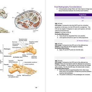 Rad Notes - Lower Extremity - Radiography Study Guide *digital Copy* - Etsy