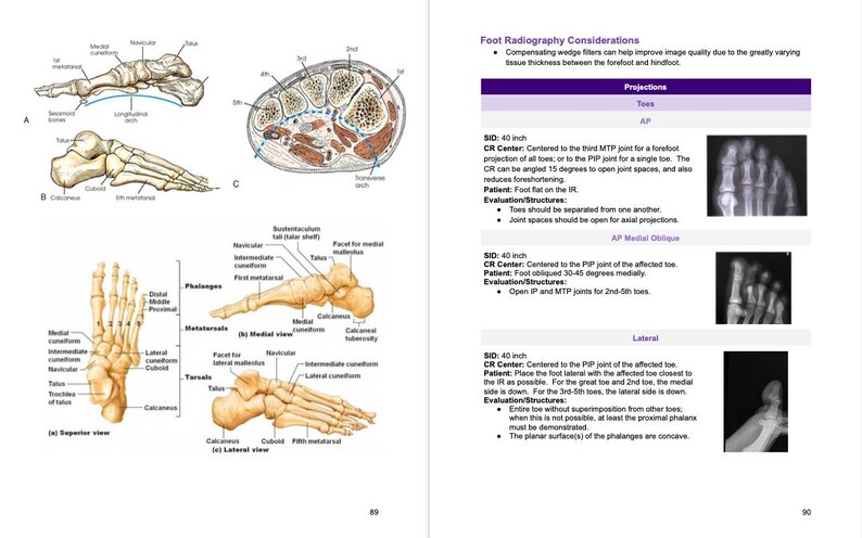 Rad Notes - Lower Extremity - Radiography Study Guide *digital Copy* - Etsy