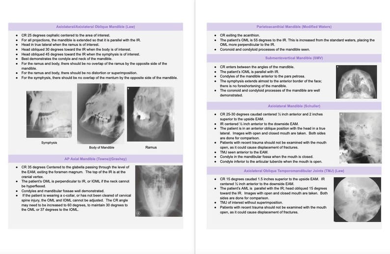 Rad Notes - Head Procedures - Radiography Study Guide *digital Copy* - Etsy