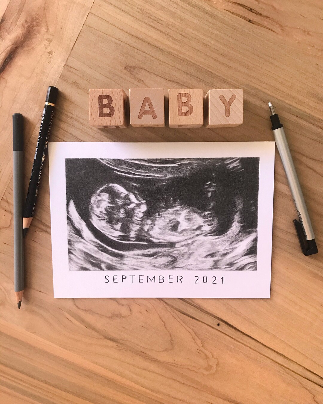Ultrasound Drawing - Etsy