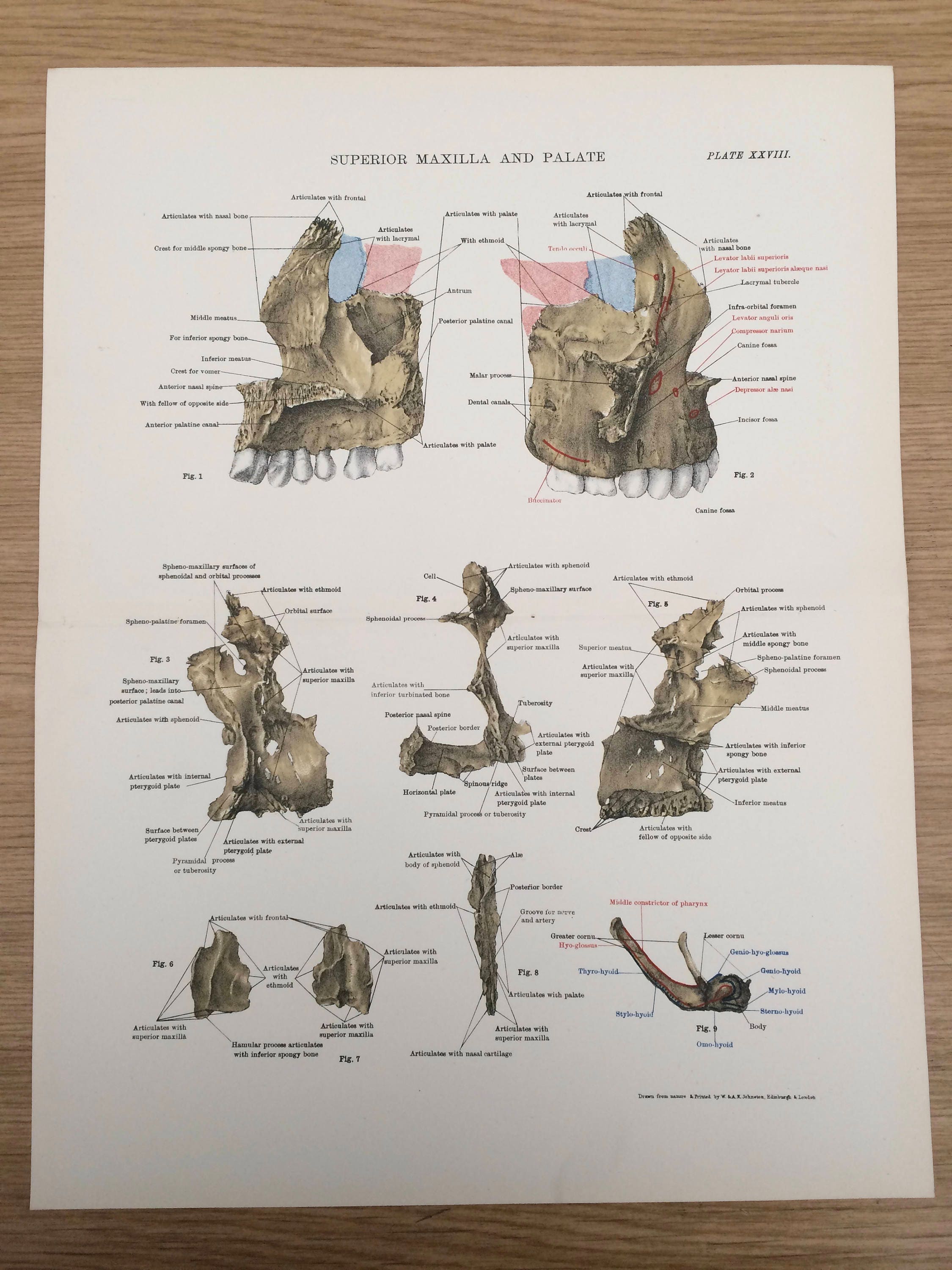 1920 Large Original Vintage Anatomical Illustration - Superior Maxilla ...