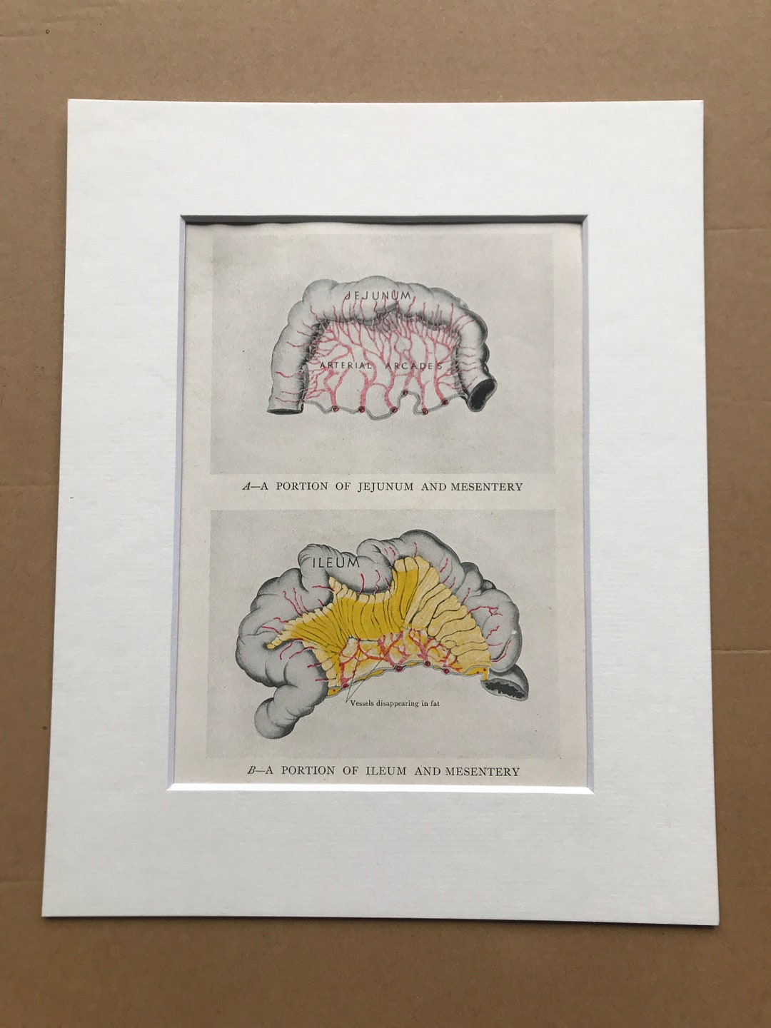 Jejunum Vs Ileum Arcade