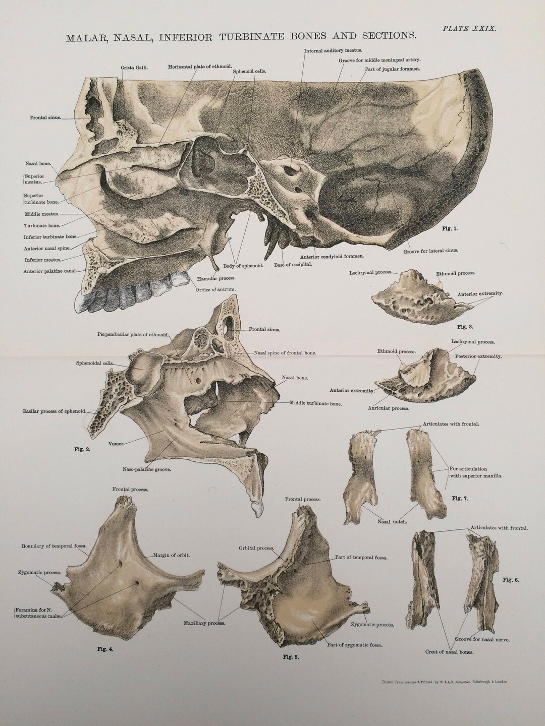 1920 Malar, Nasal, Inferior, Huesos de Cornetes Grabado Antiguo ...