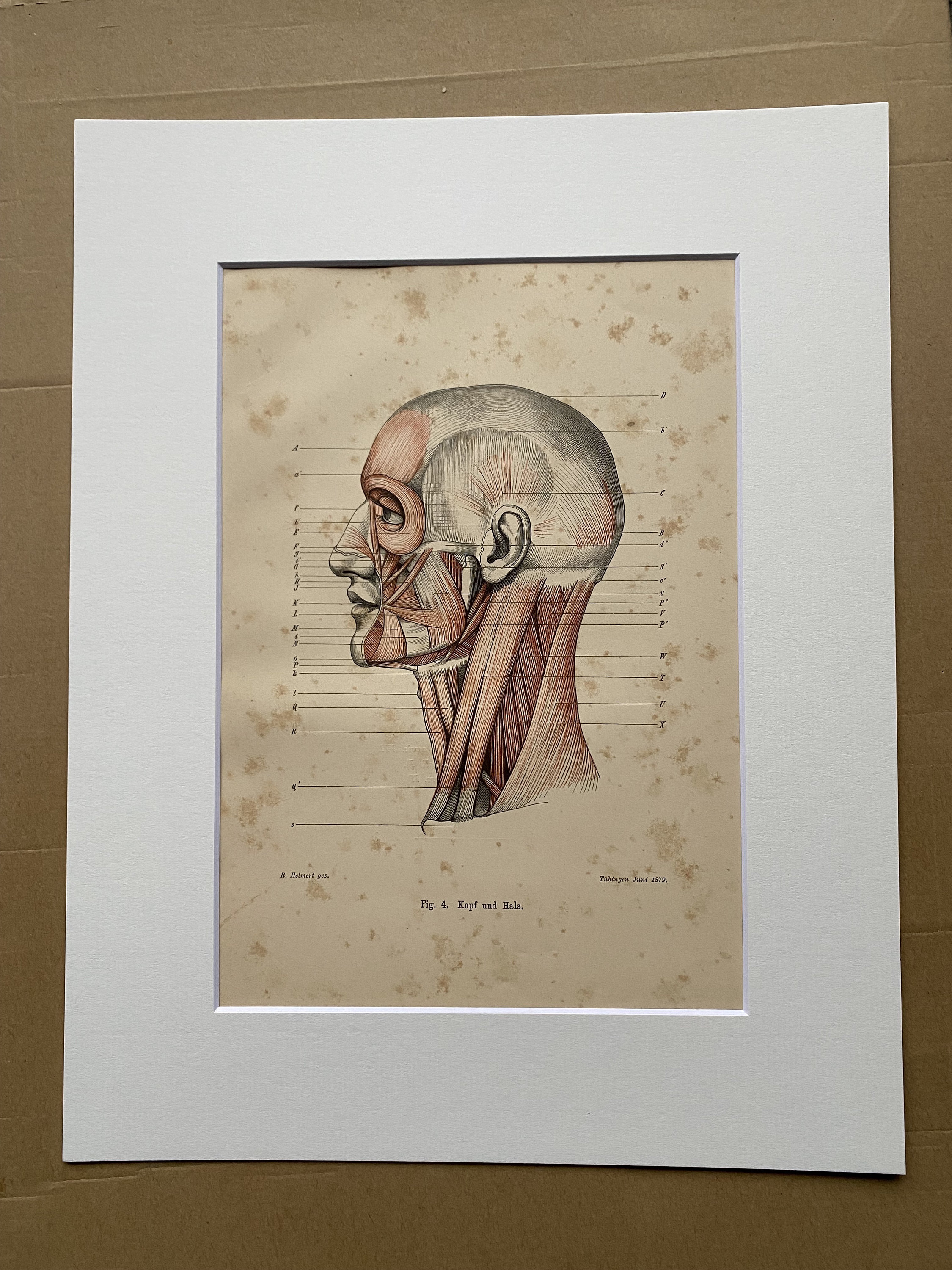 1890 Original Antique Anatomical Print - Head and Neck Muscles ...