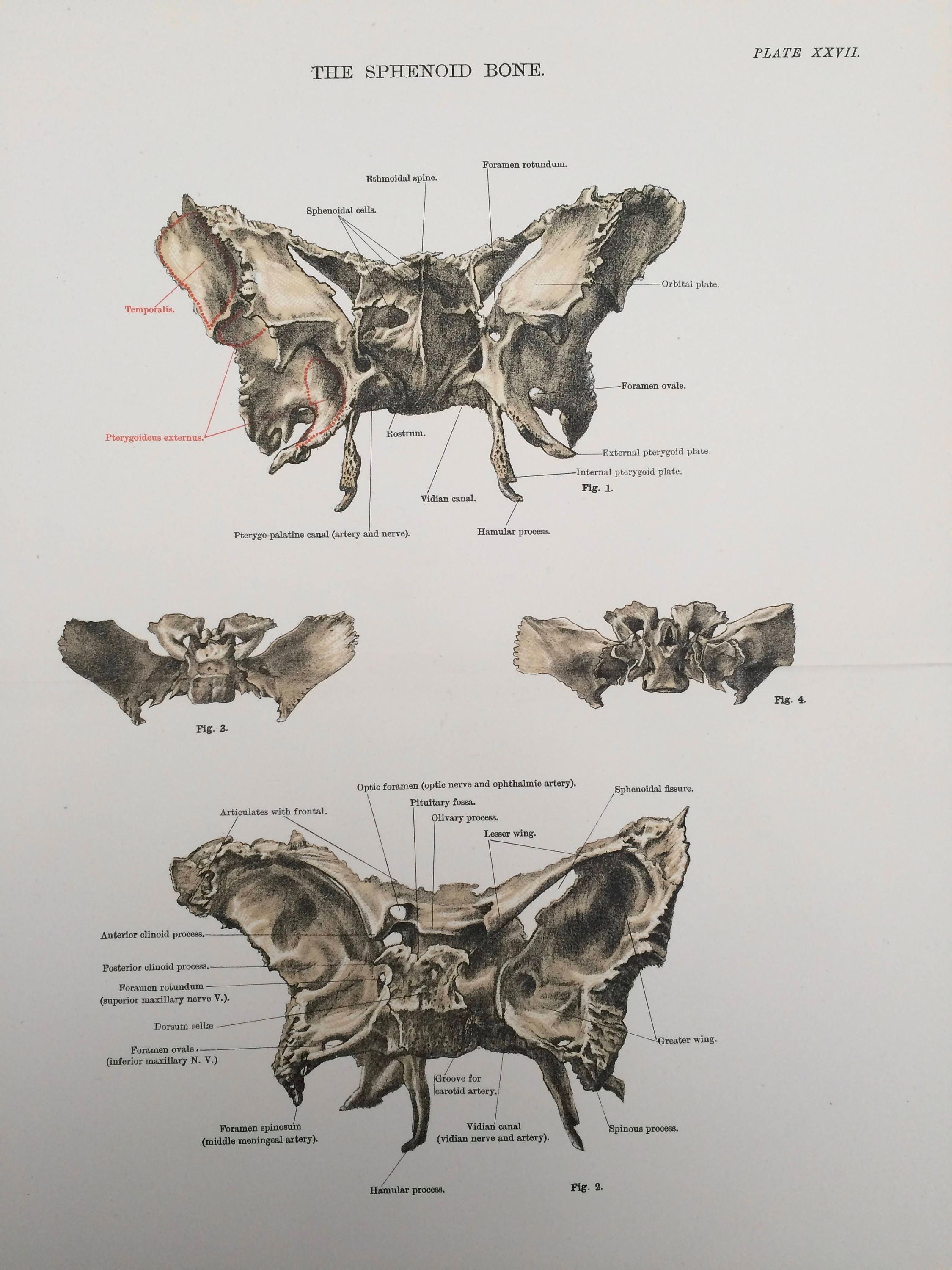 1920 Large Original Vintage Anatomical Illustration - The Sphenoid Bone ...