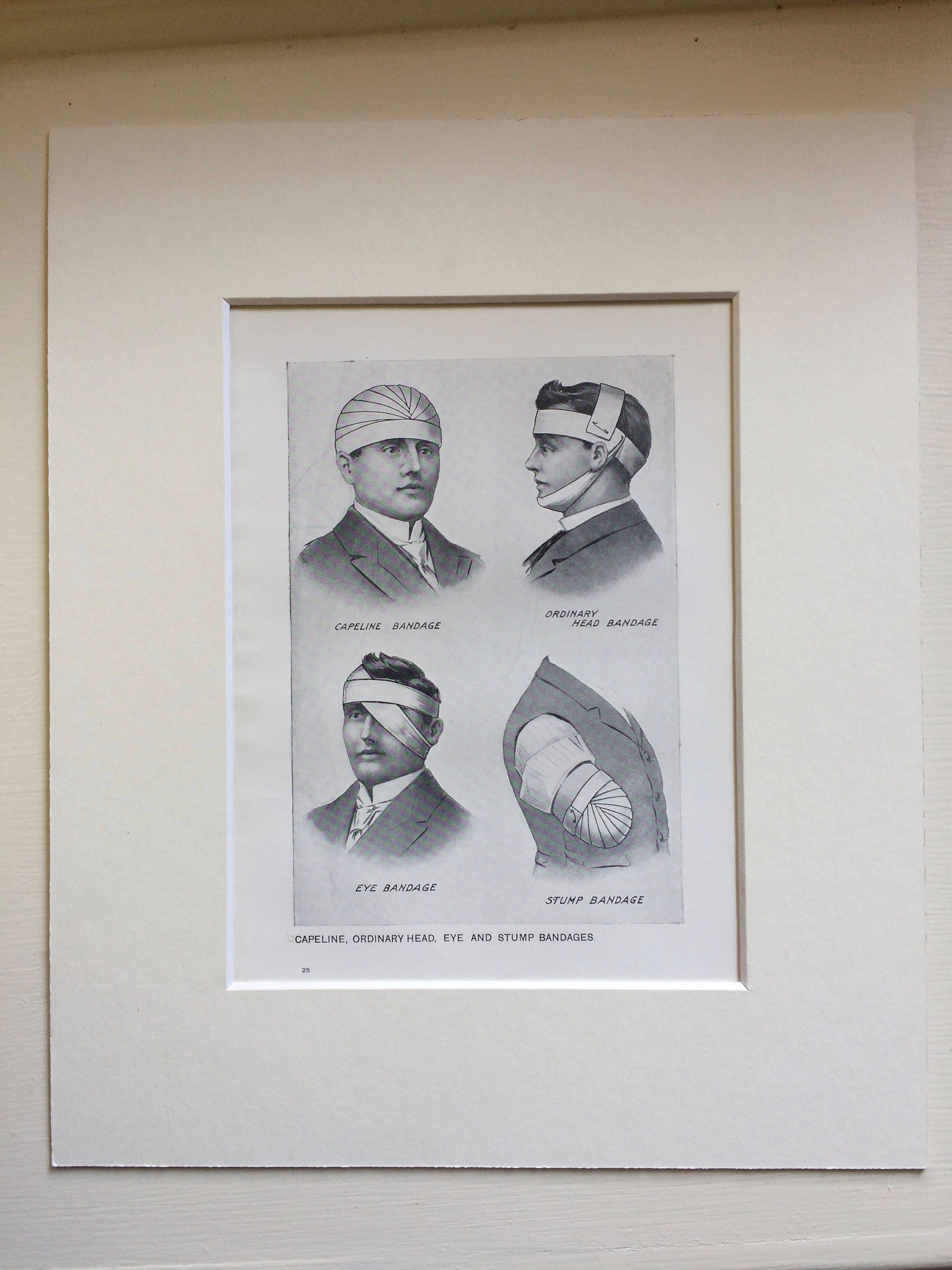 1920s Original Antique Matted Anatomical Print - Bandage Types ...