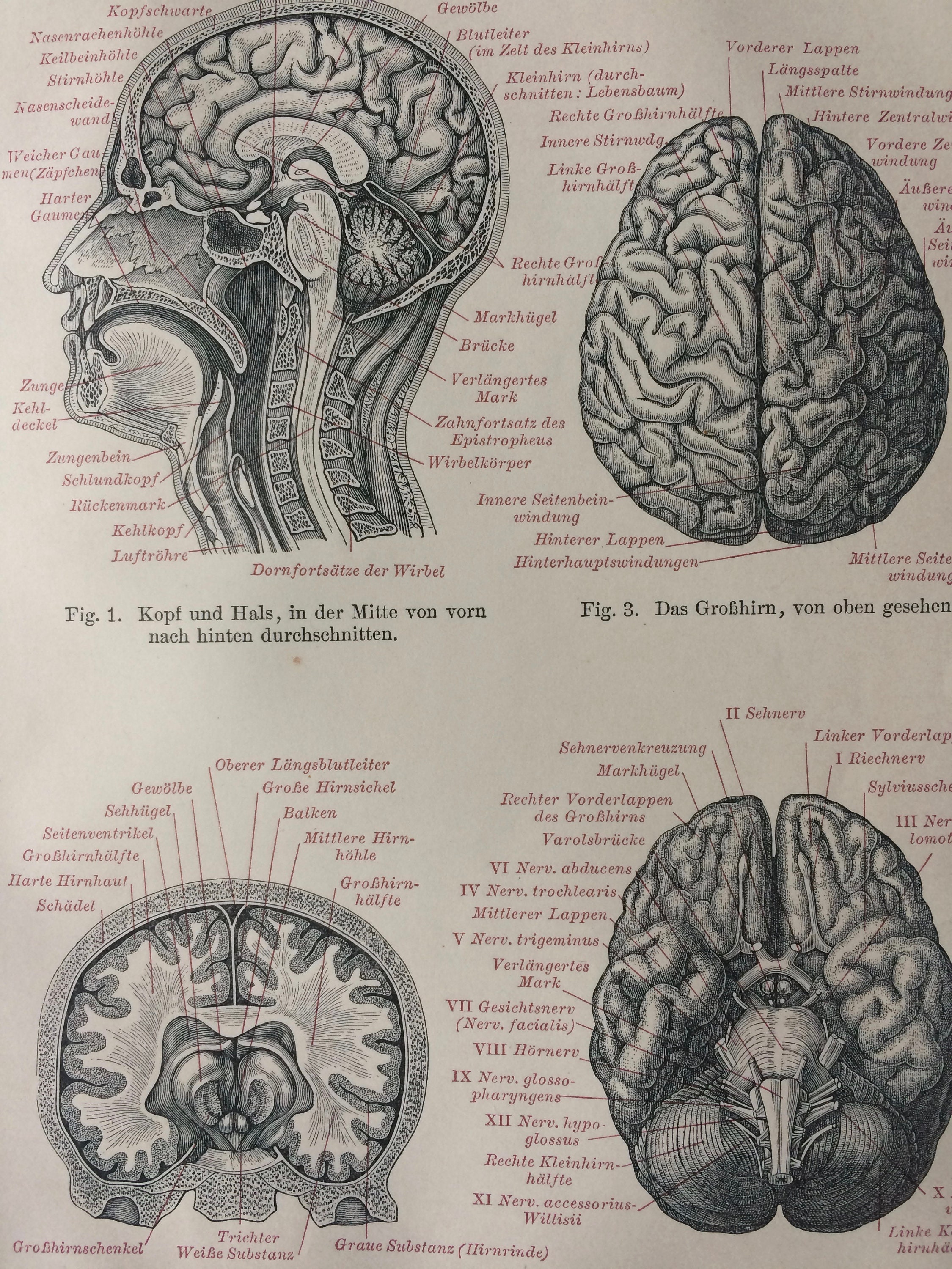 1895 Human Brain Original Antique Lithograph - Mounted and Matted ...