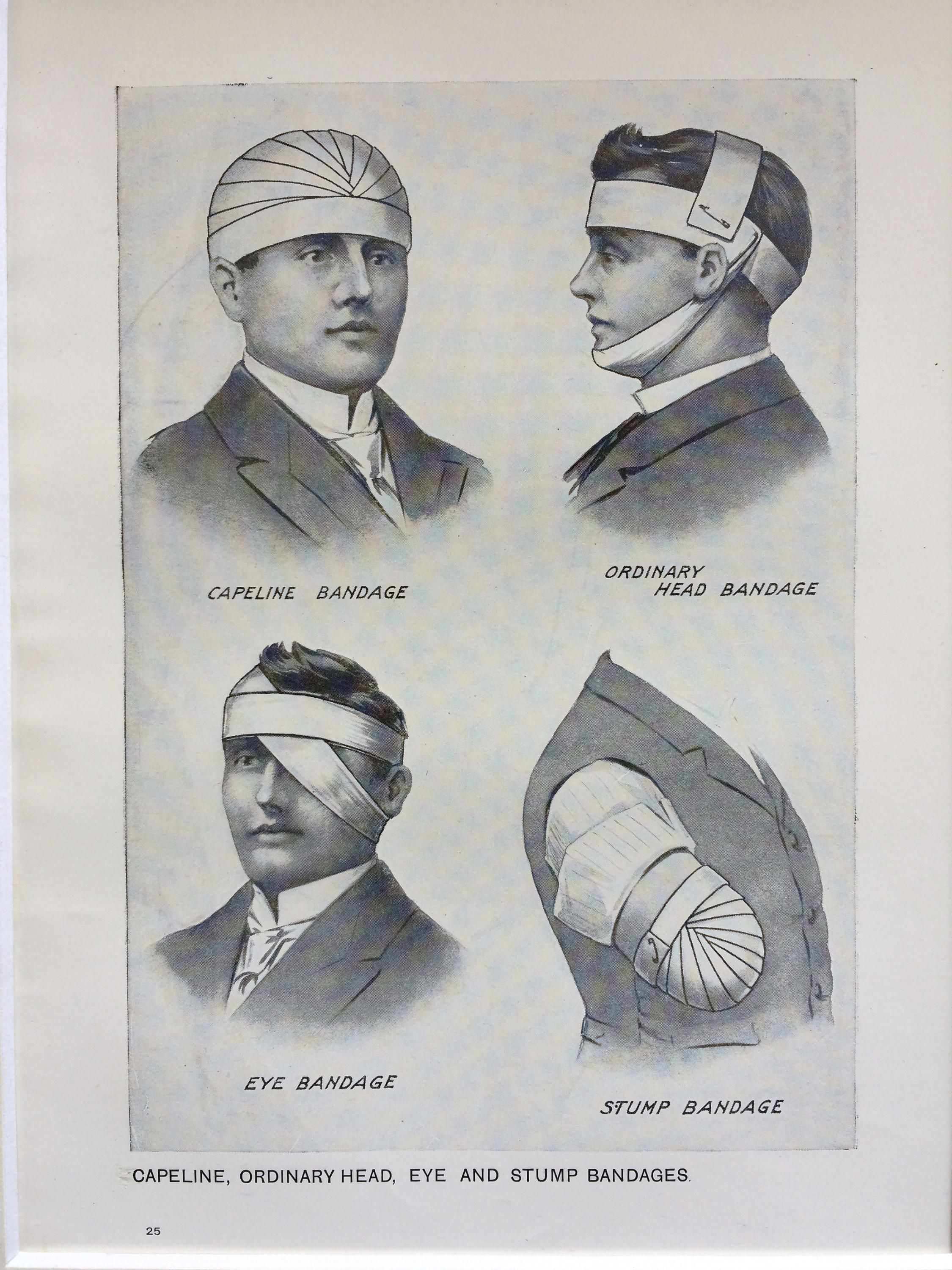 1920s Original Antique Matted Anatomical Print - Bandage Types ...