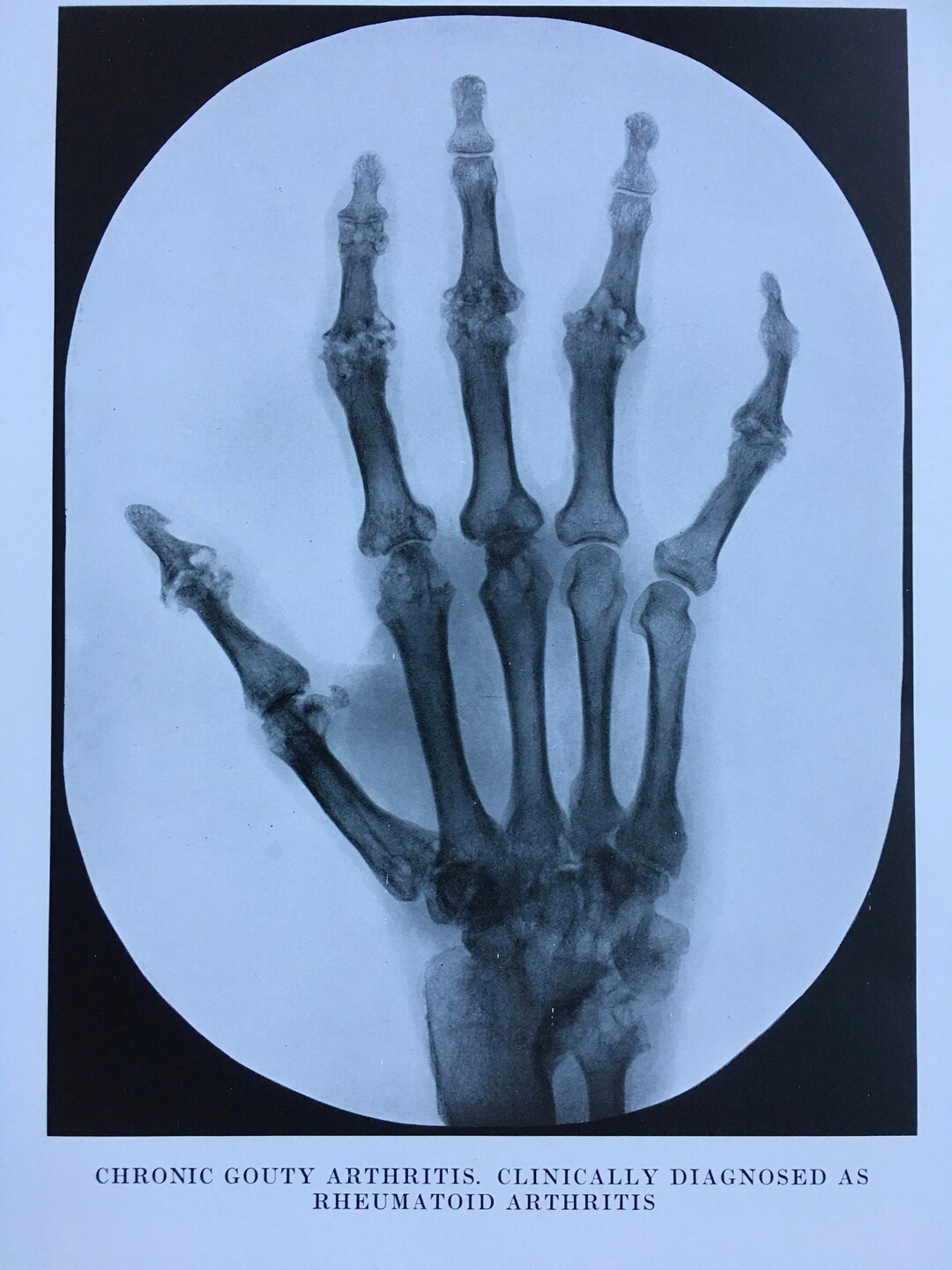 1935 Original Vintage Print Mounted and Matted Radiology - Etsy