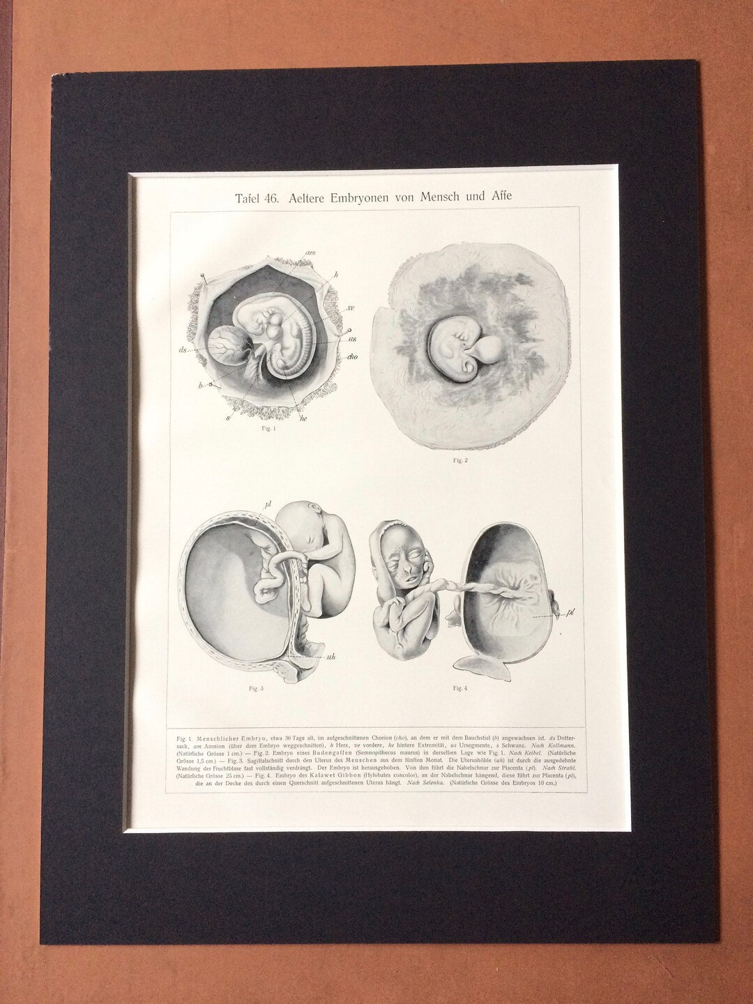 1909 Embryos of Humans and Monkeys Large Original Antique - Etsy