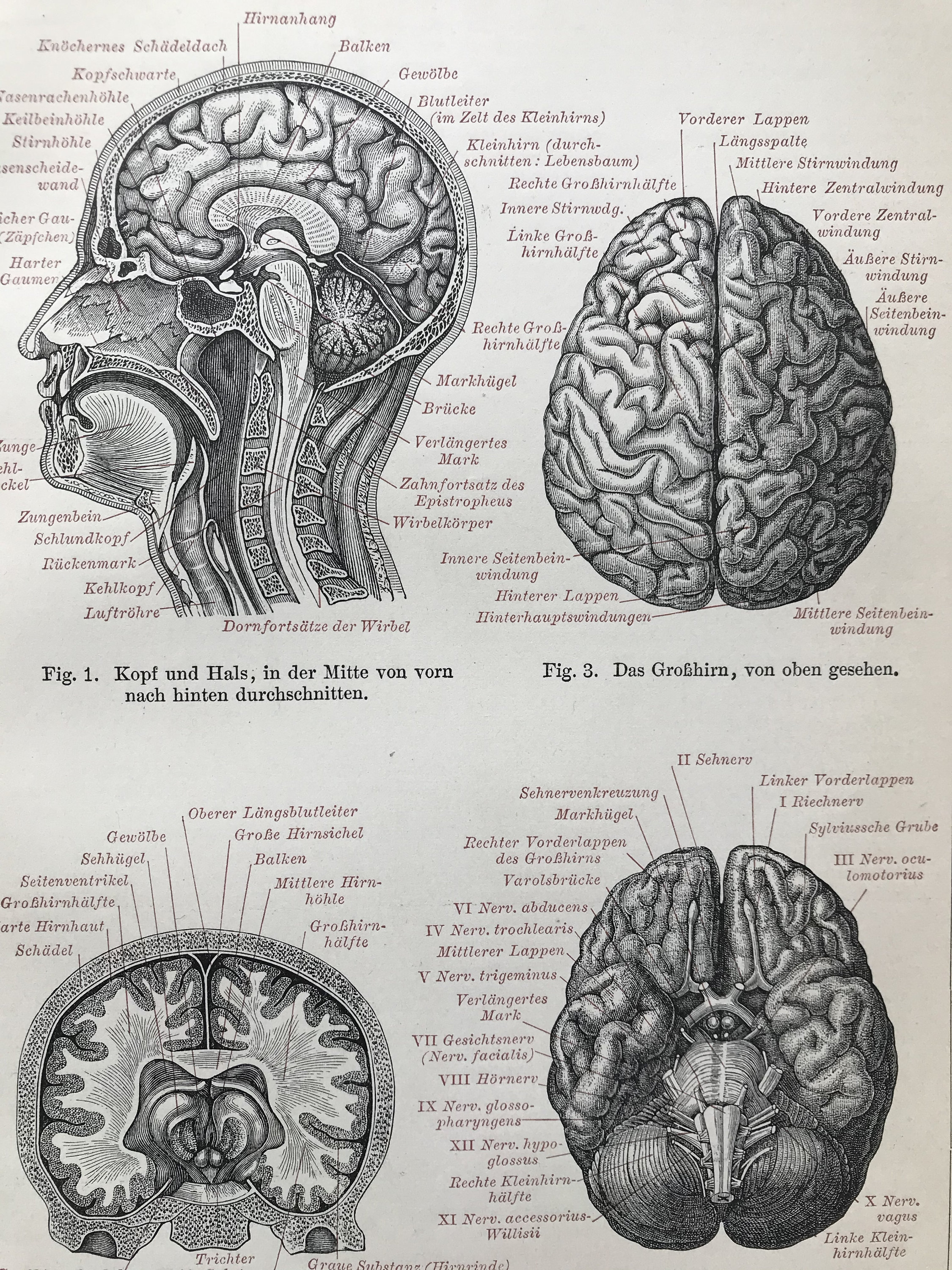 1895 Human Brain Original Antique Lithograph - Mounted and Matted ...