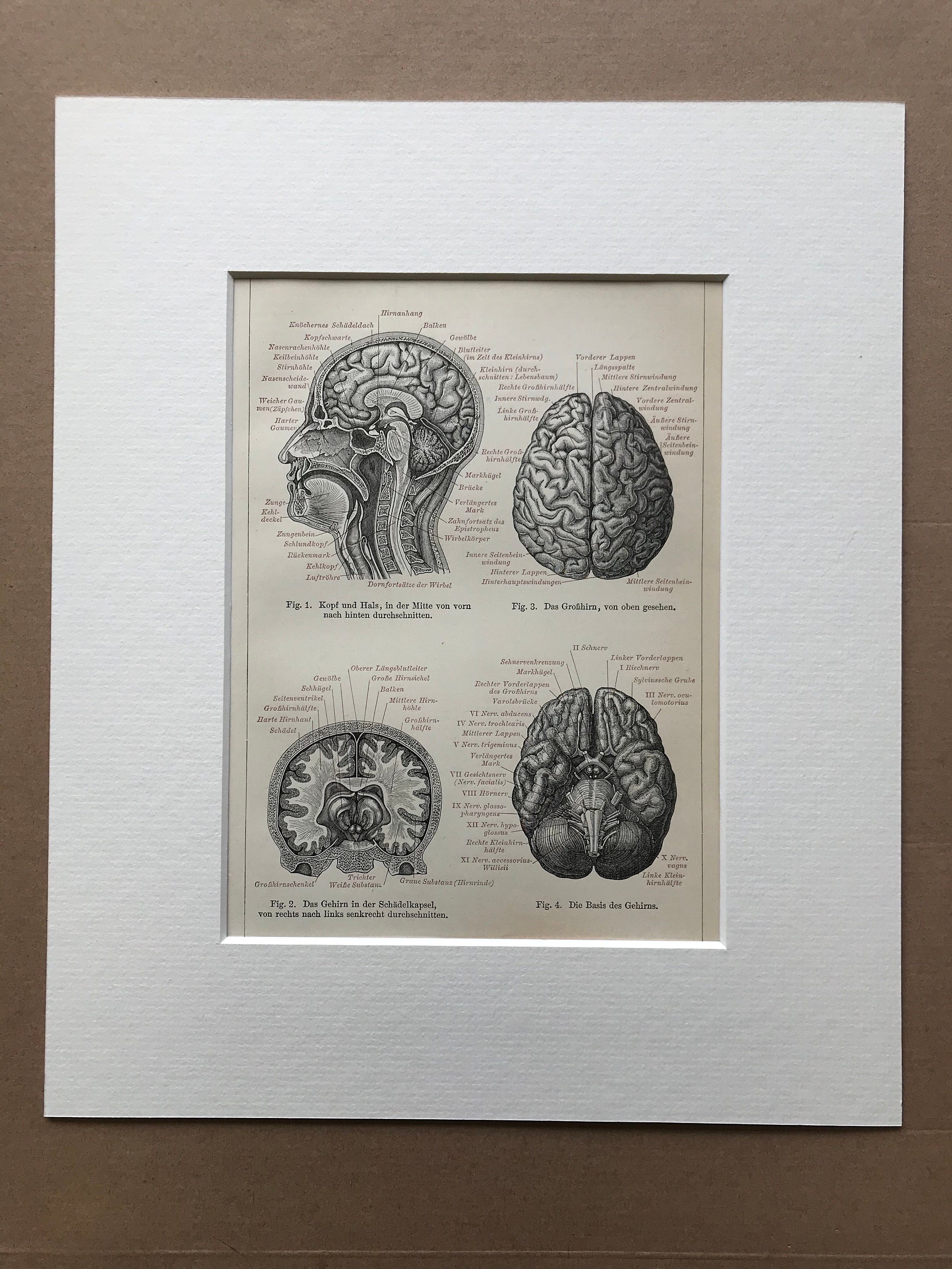 1895 Human Brain Original Antique Lithograph - Mounted and Matted ...