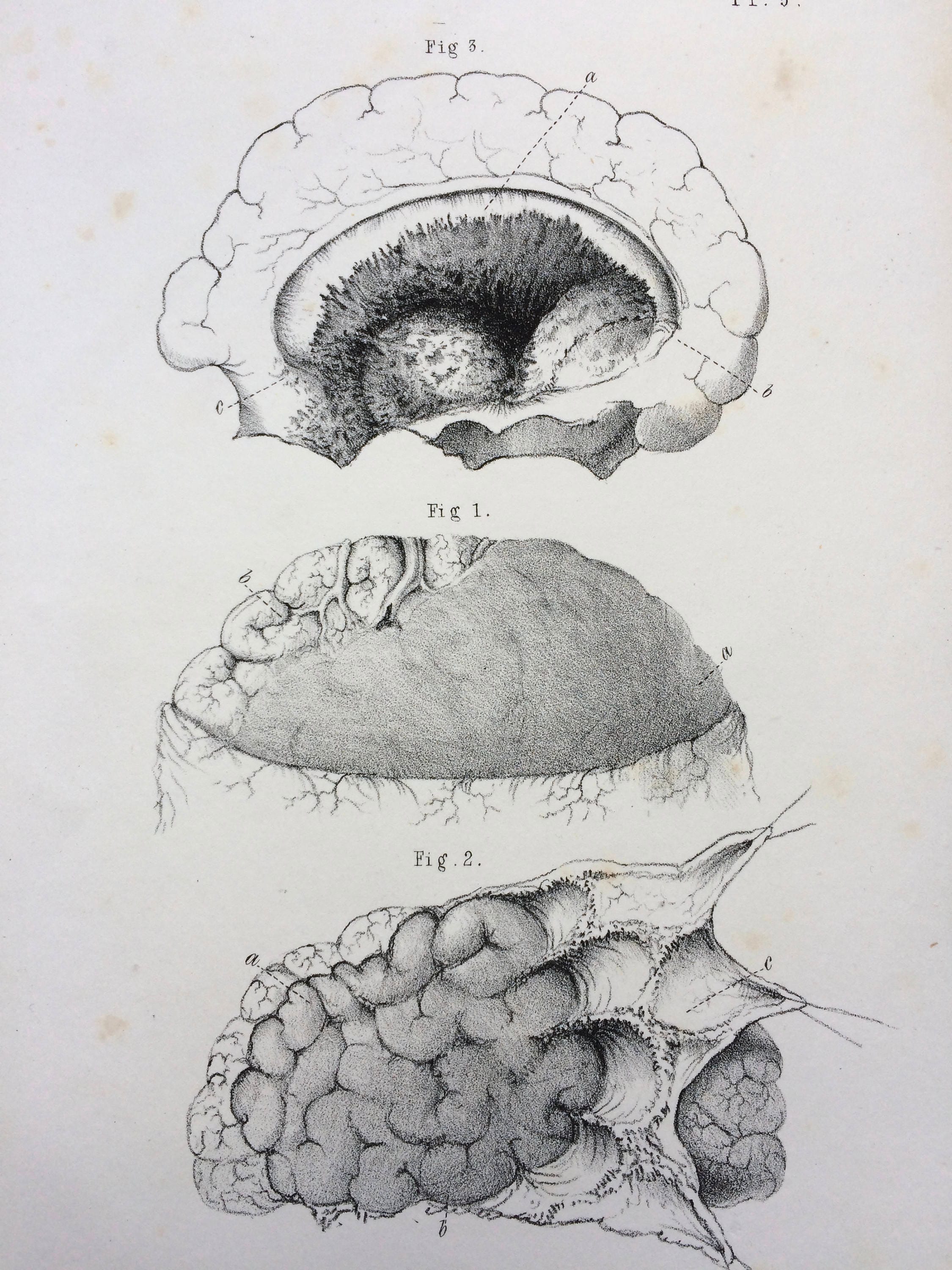 1831 Original Antique Anatomical Print by W. Money - Morbid Anatomy ...