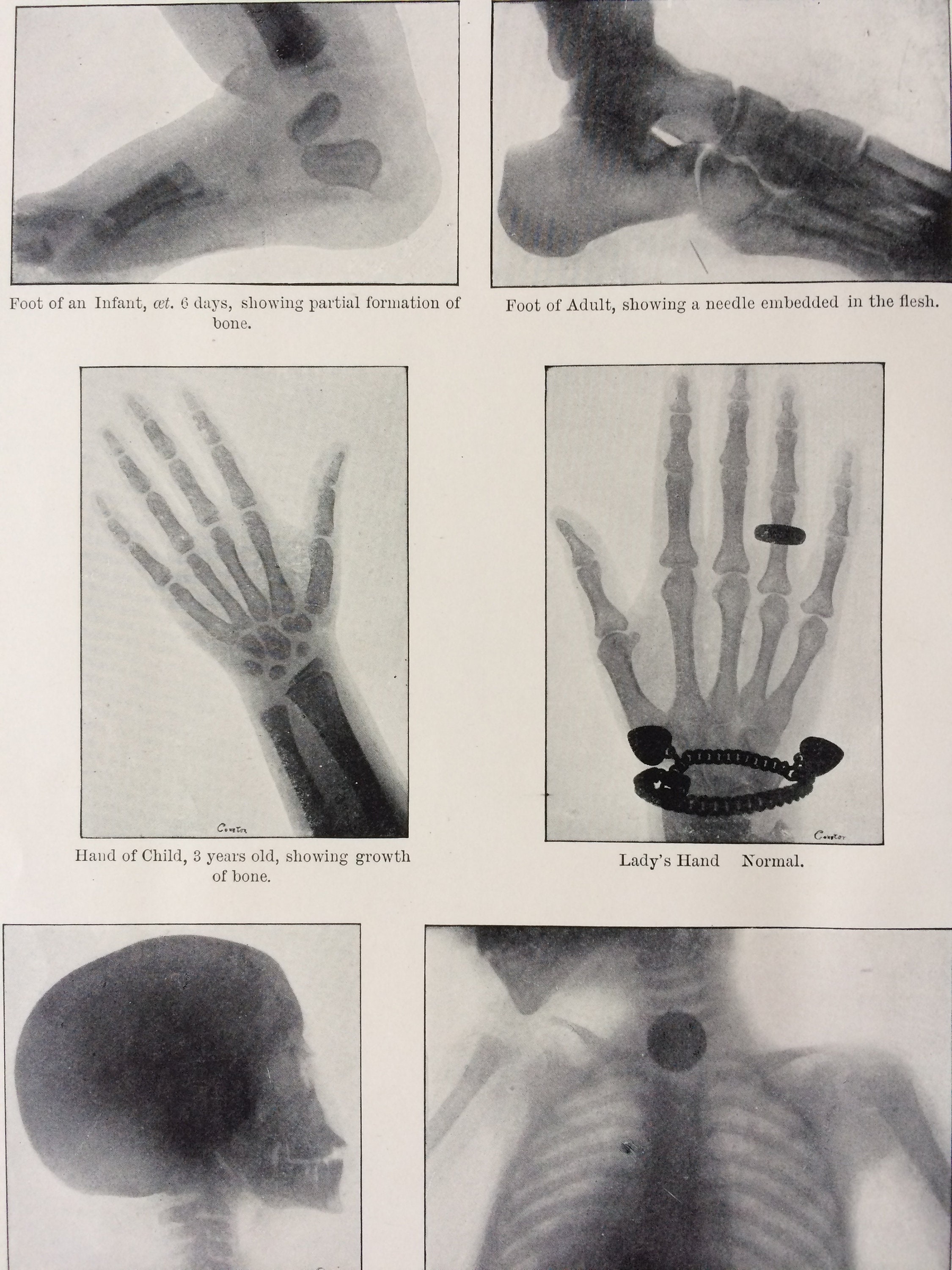 1900 X Ray Original Antique Print - Mounted and Matted - 10 x 12 inches ...