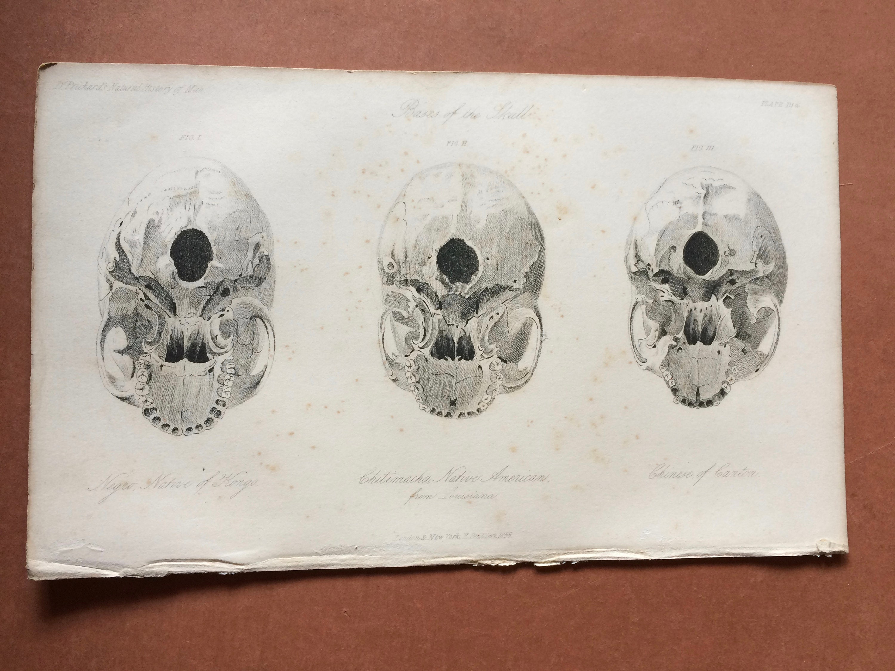 1855 Skull Comparison - Negro Native of Kongo, Chitimacha Native ...