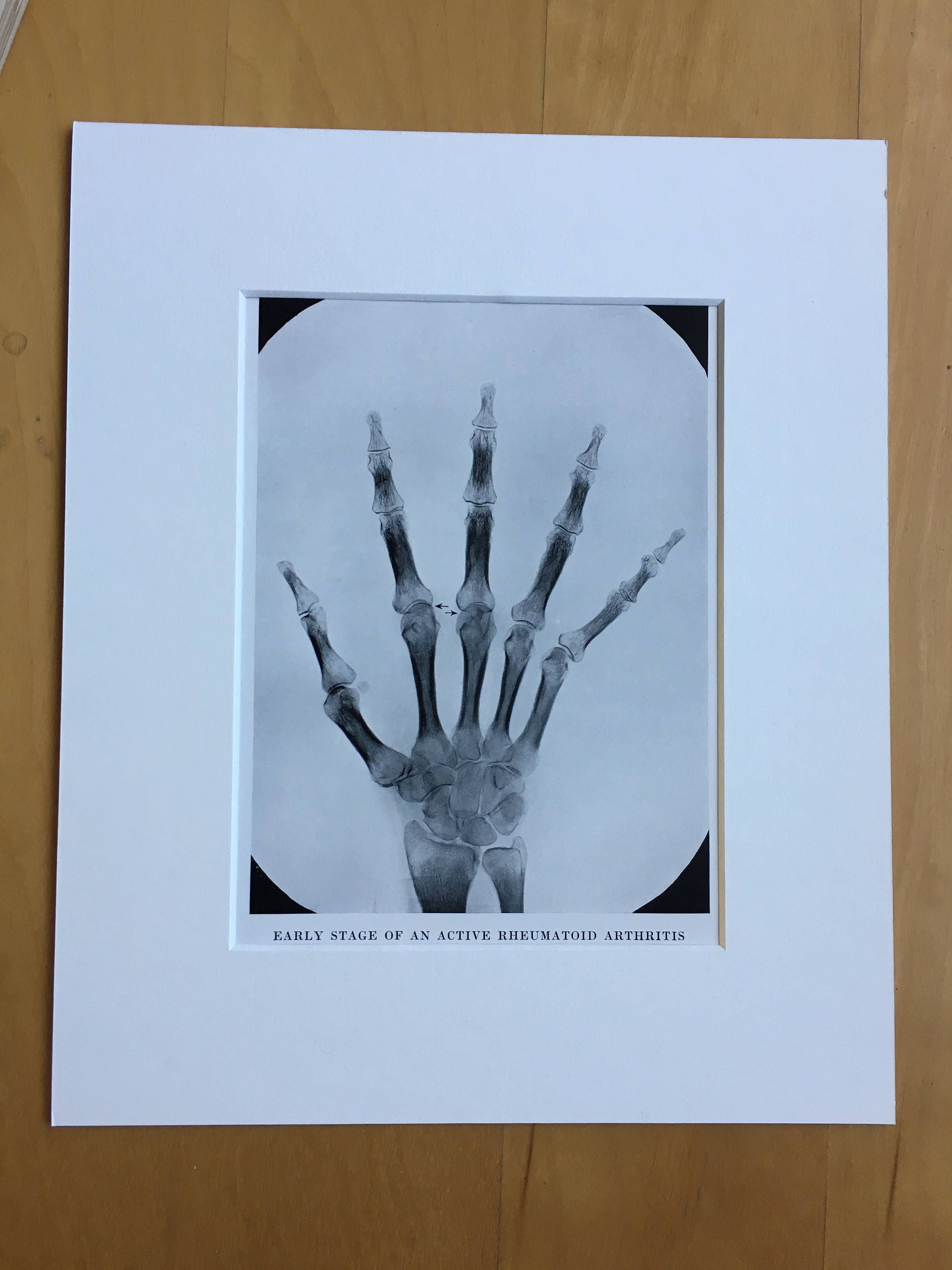 1935 Original Vintage Print - matted & ready to frame - Radiology ...