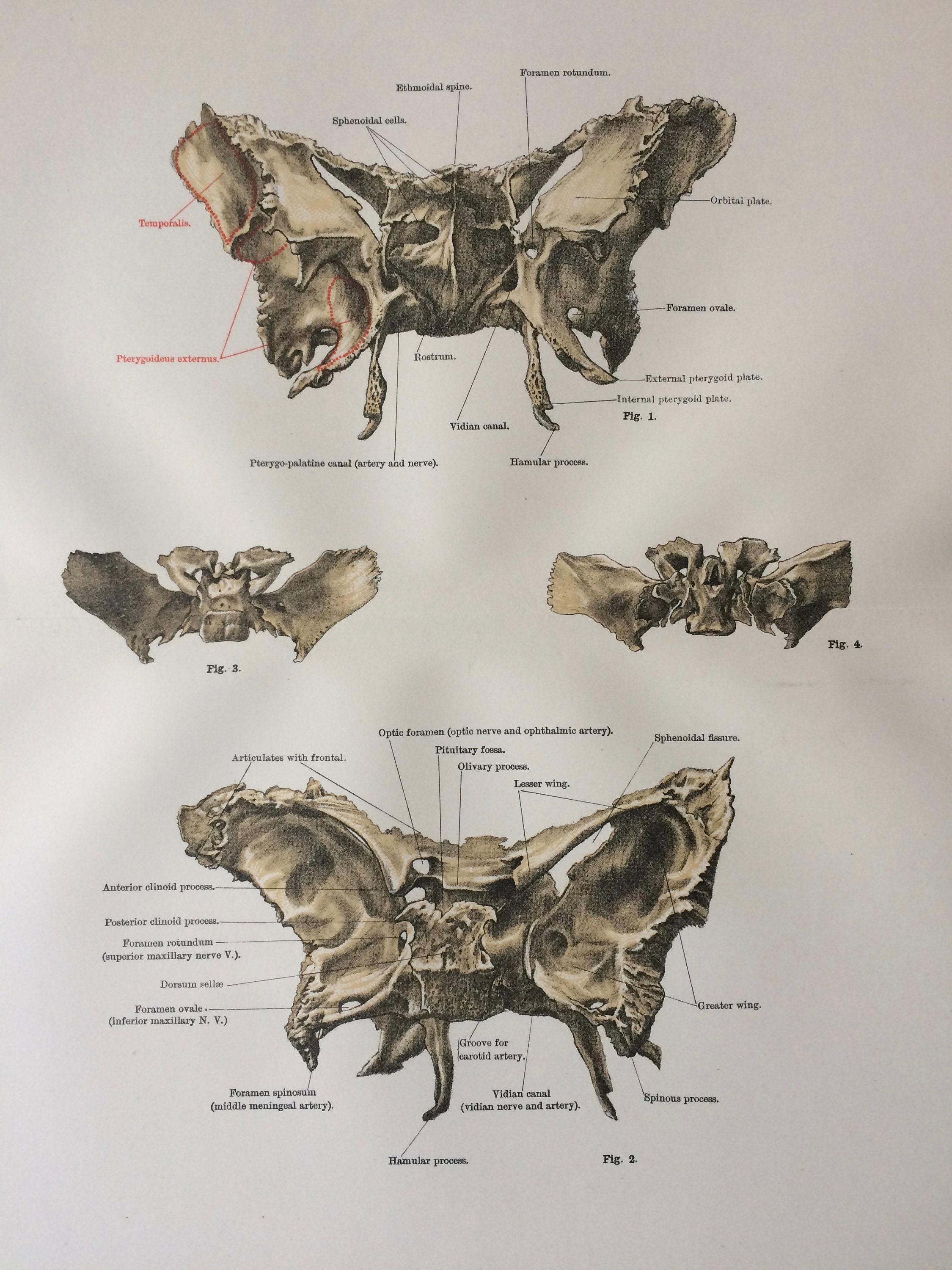 1920 Large Original Vintage Anatomical Illustration - The Sphenoid Bone ...