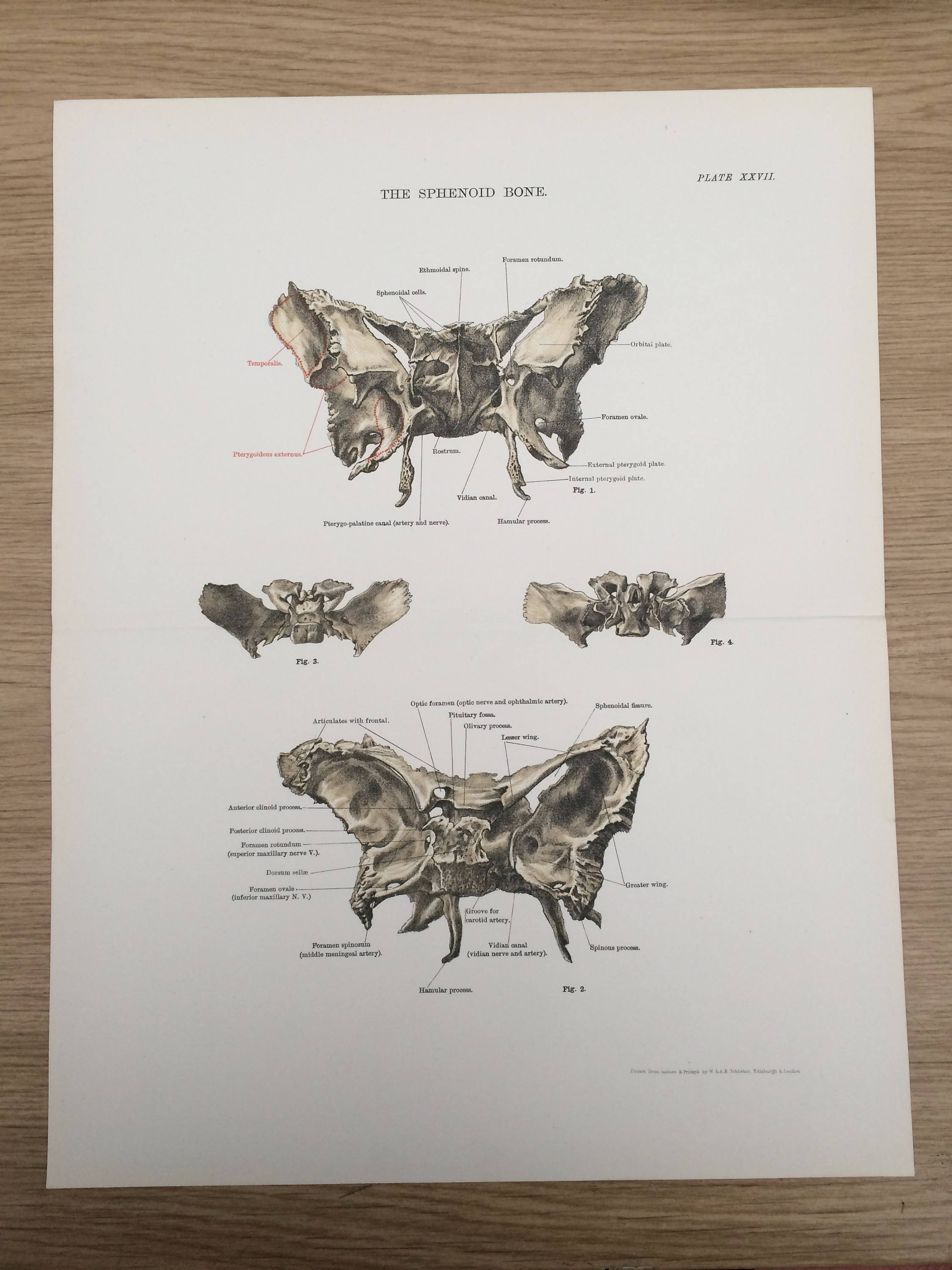1920 Large Original Vintage Anatomical Illustration - The Sphenoid Bone ...