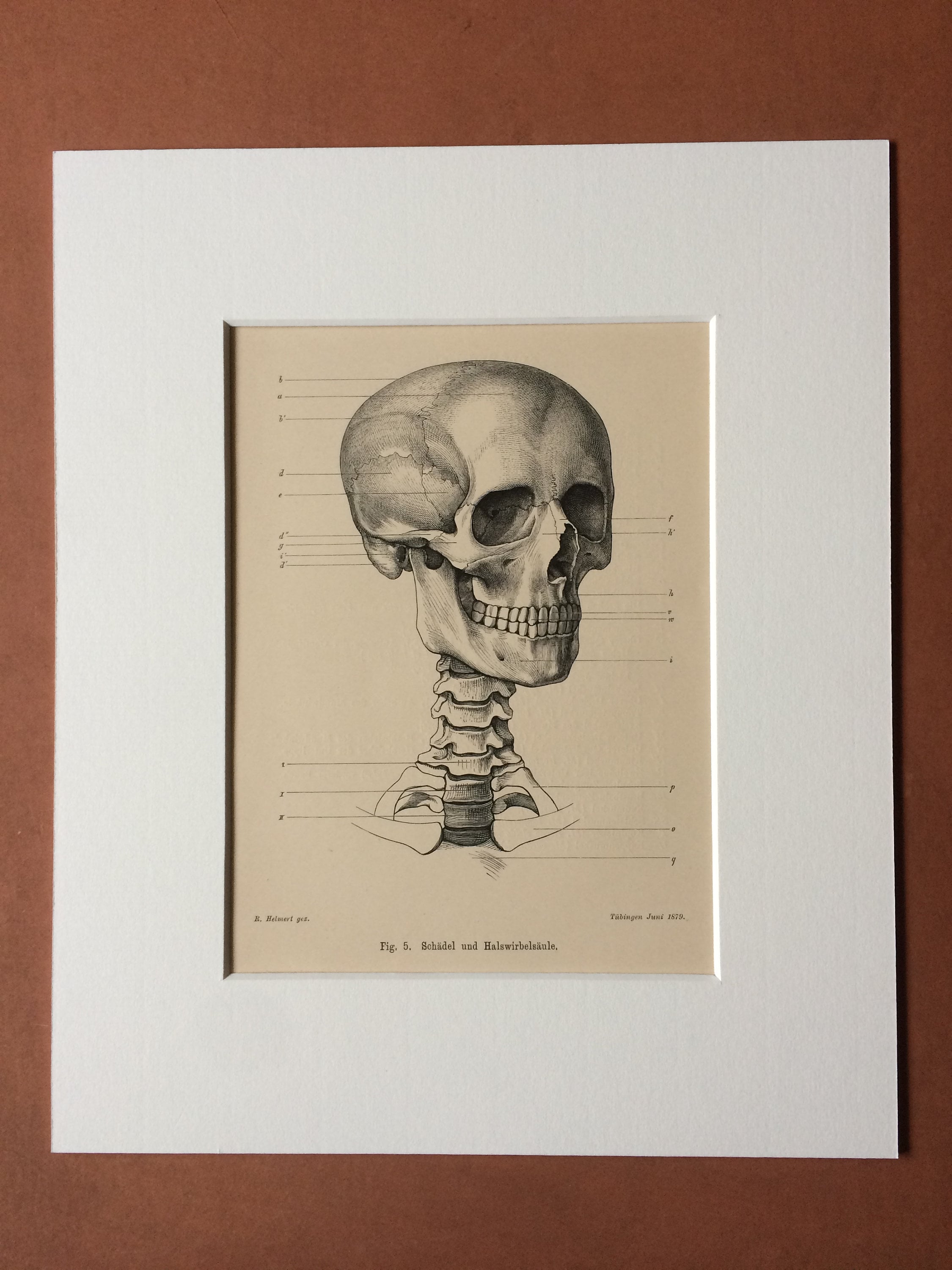 1890 Original Antique Anatomical Print - Skull and Vertebrae - Cranium ...