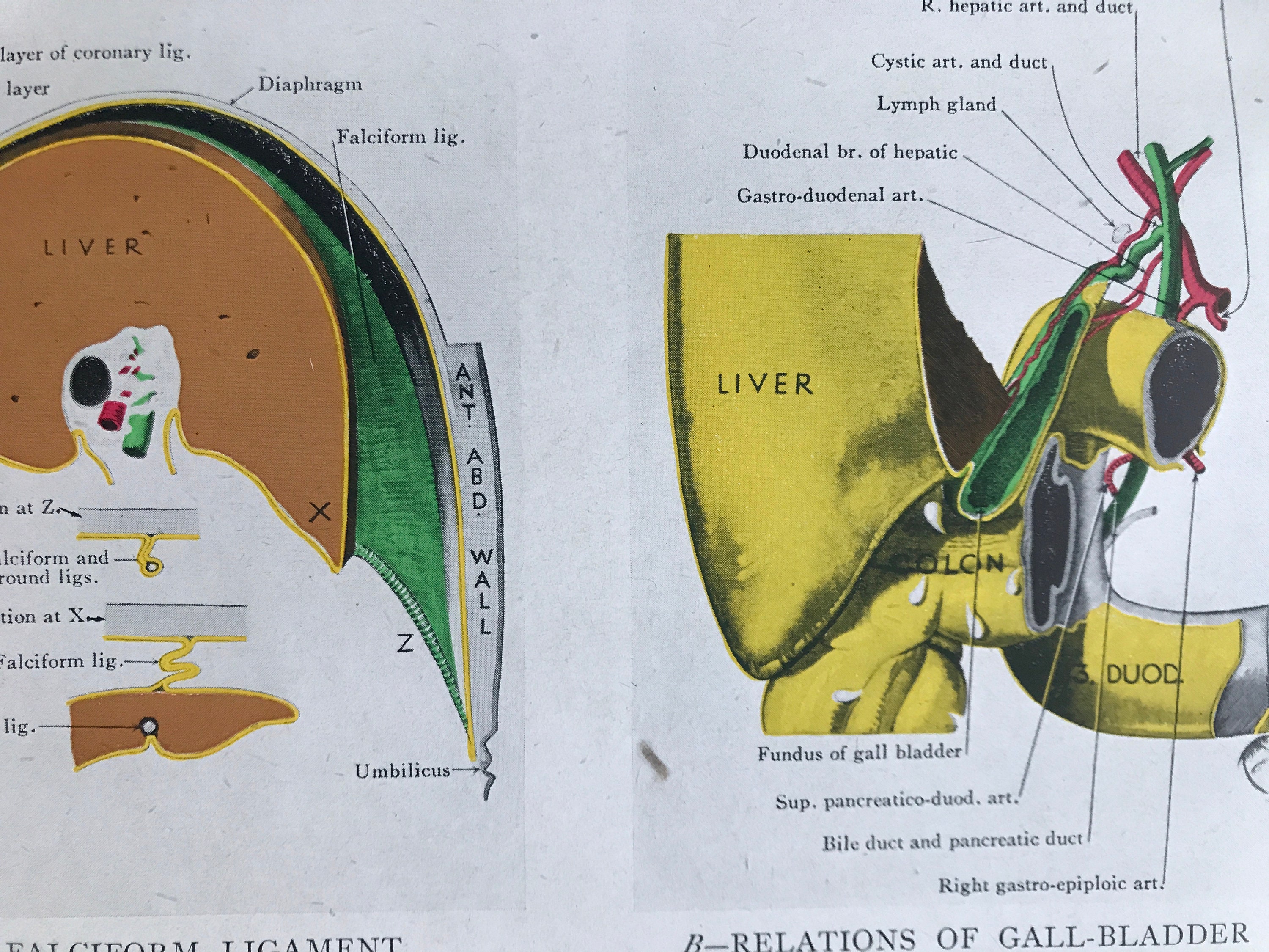 Falciform Ligament Cat